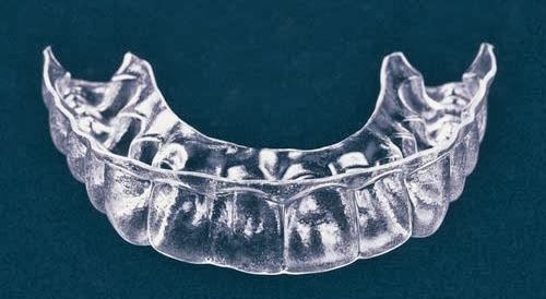 Retención dental en ortodoncia